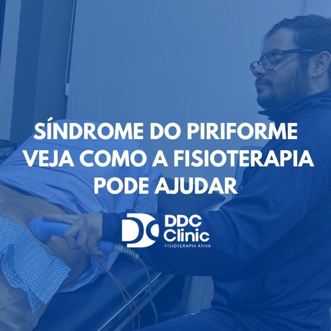 Síndrome do Piriforme: Veja Como a Fisioterapia Pode Ajudar - DDC Clinic